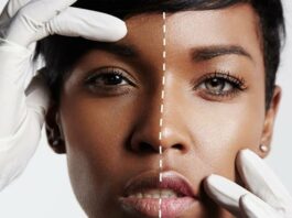 6 Negative Health Effects Of Bleaching Skin - Health Guide NG